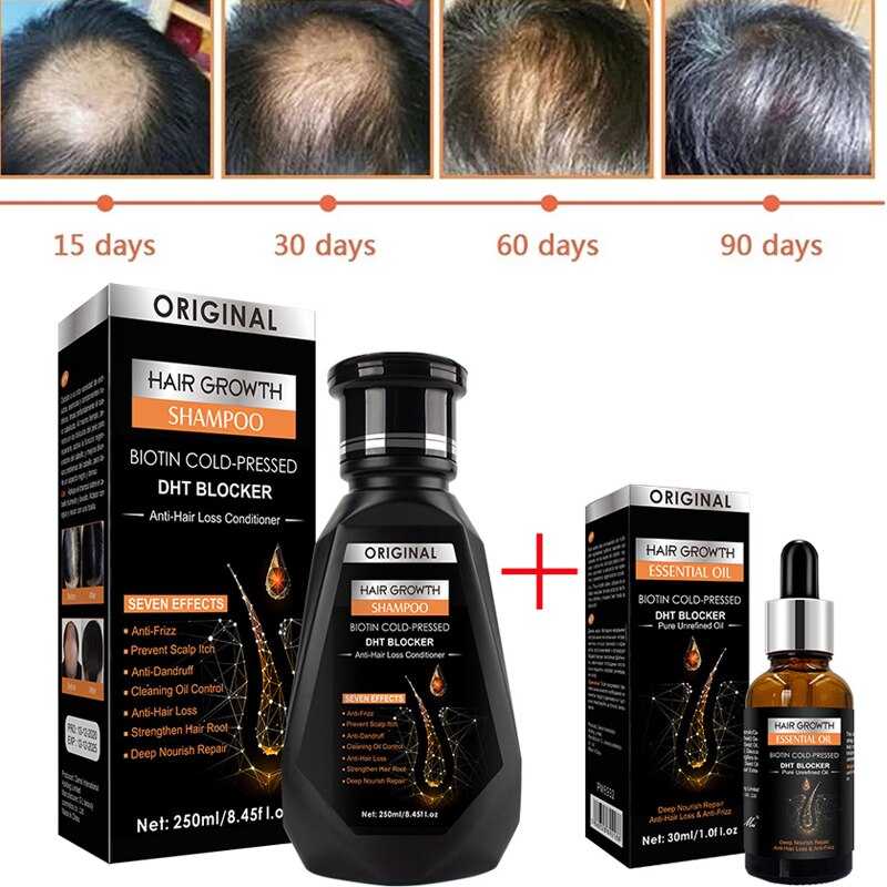 Hair Growth Essential Oil Biotin Cold-Pressed DHT Blocker and Hair Gro ...
